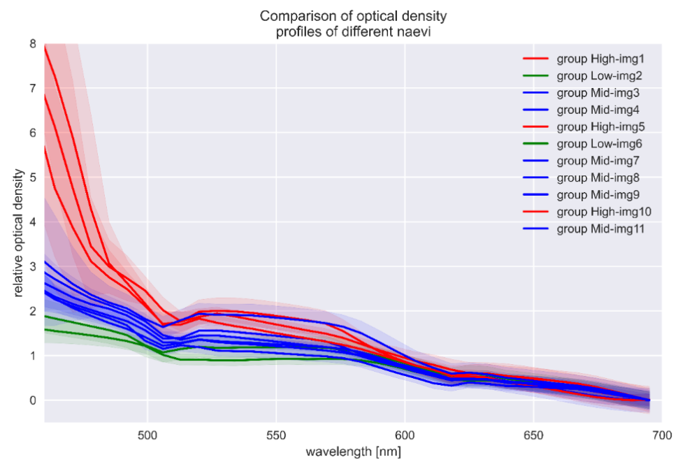 Choroidal Naevi Breakthrough: Navigating Success with Hyperspectral ...